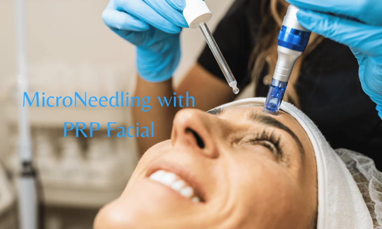 Fighting Signs of Aging: Exploring Microneedling with PRP Facials